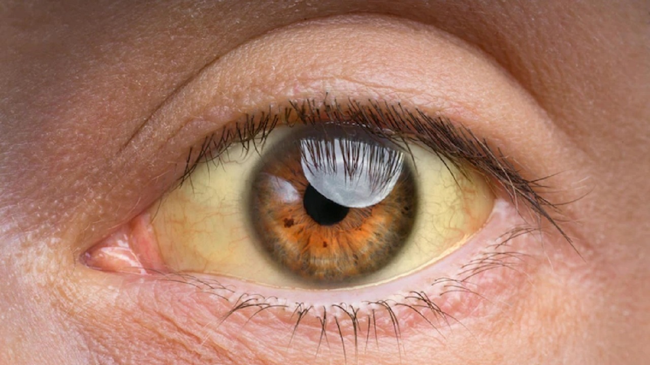 Alerta: Médicos reforçam a importância de prevenir e tratar ...